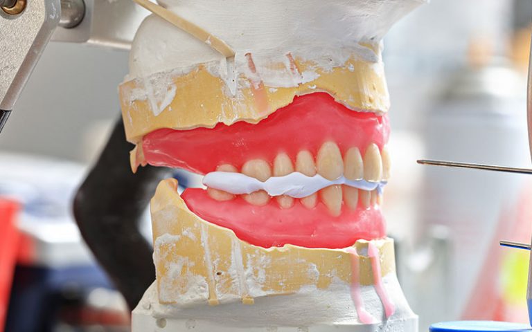 Aesthetic Dental & Denture Clinic - Dental health - Quality Dentures